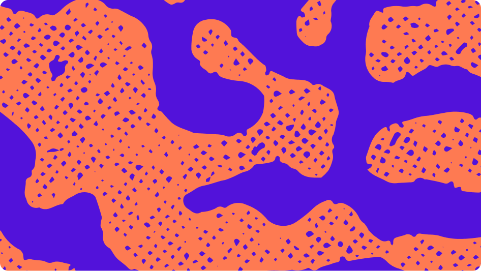 Le myélogramme (ponction de moelle) : Déroulement, RDV et résultats en 72h